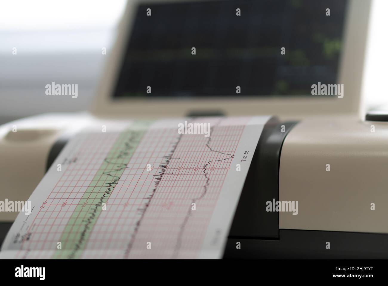 Electronic Cardiotocography Machine Monitoring Fetal Heart Contractions ...