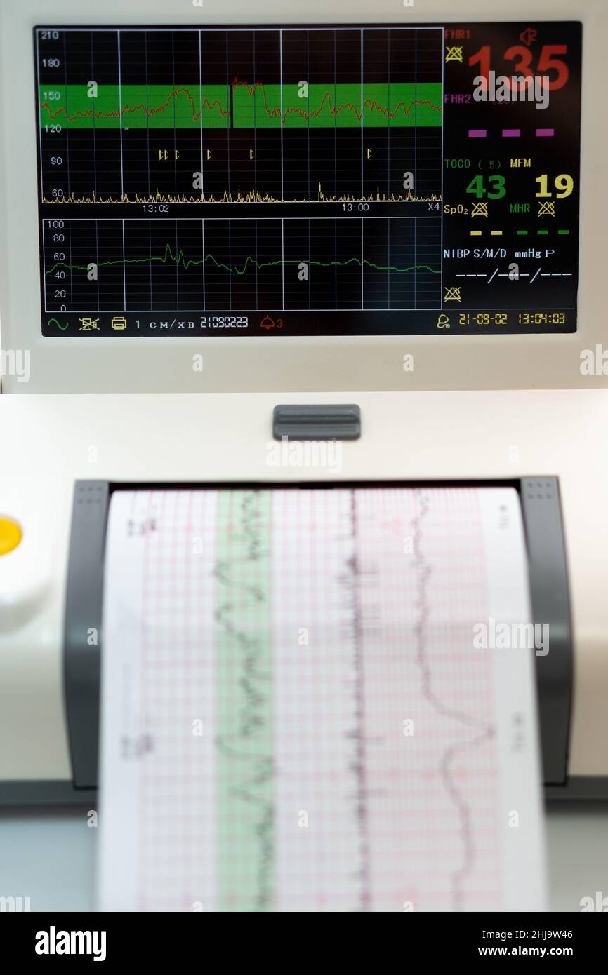 Electronic Cardiotocography Machine Monitoring Fetal Heart Contractions ...