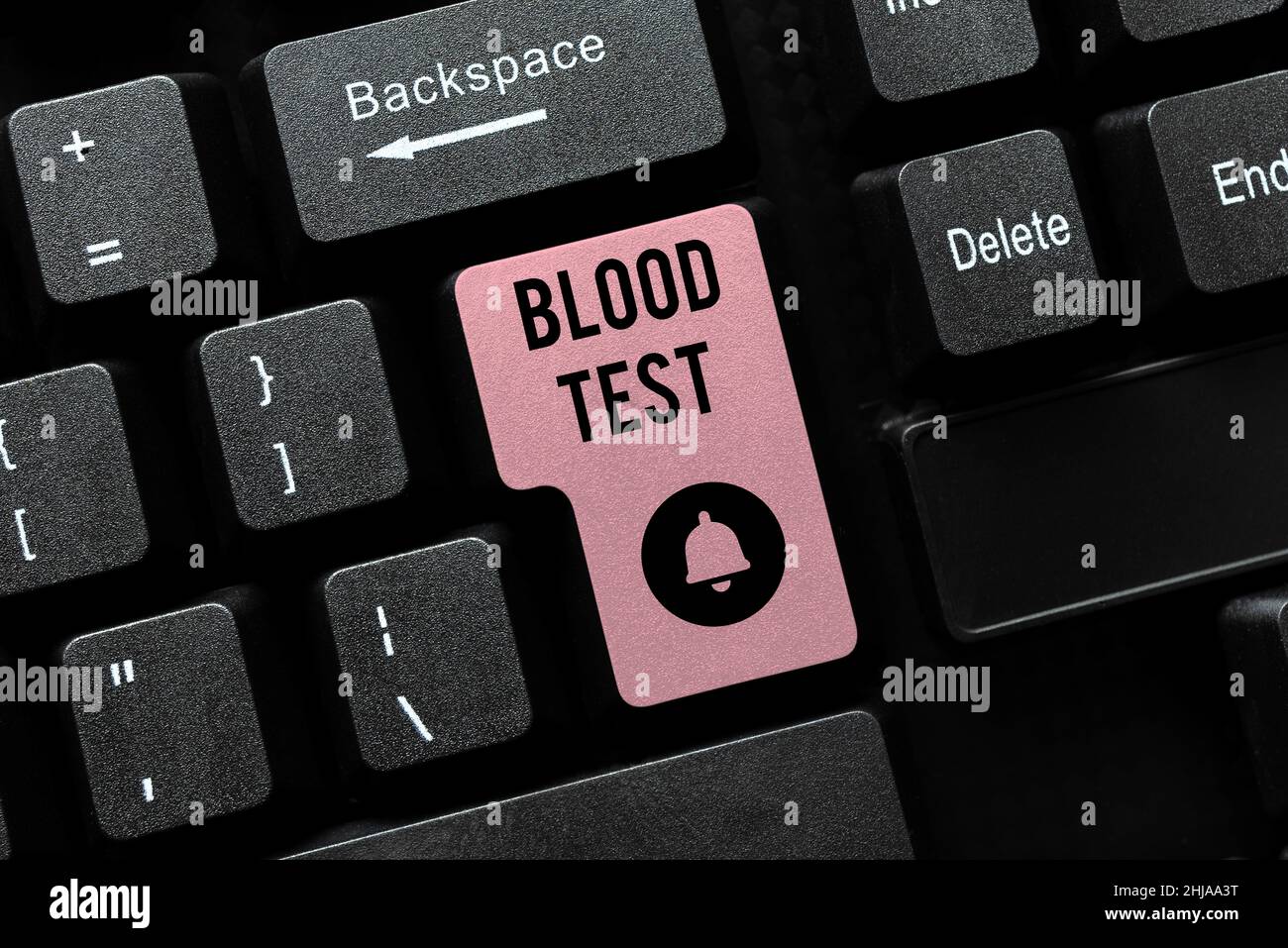 Inspiration showing sign Blood Test. Conceptual photo Extracted blood ...