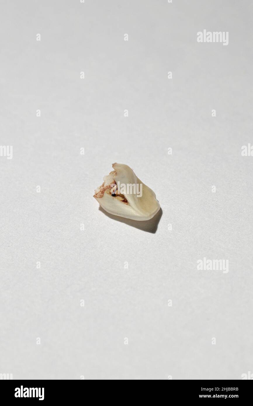 Vertical shot of torn out canine tooth with blood stains in upper root ...