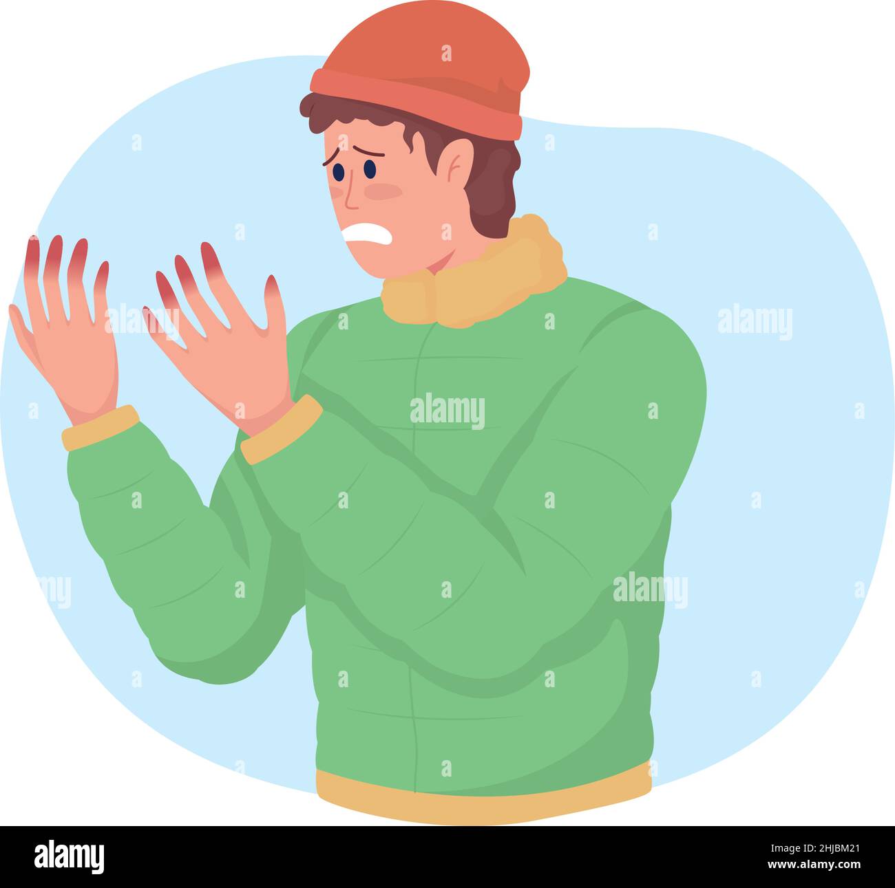 Frostbite on fingers from cold 2D vector isolated illustration Stock ...