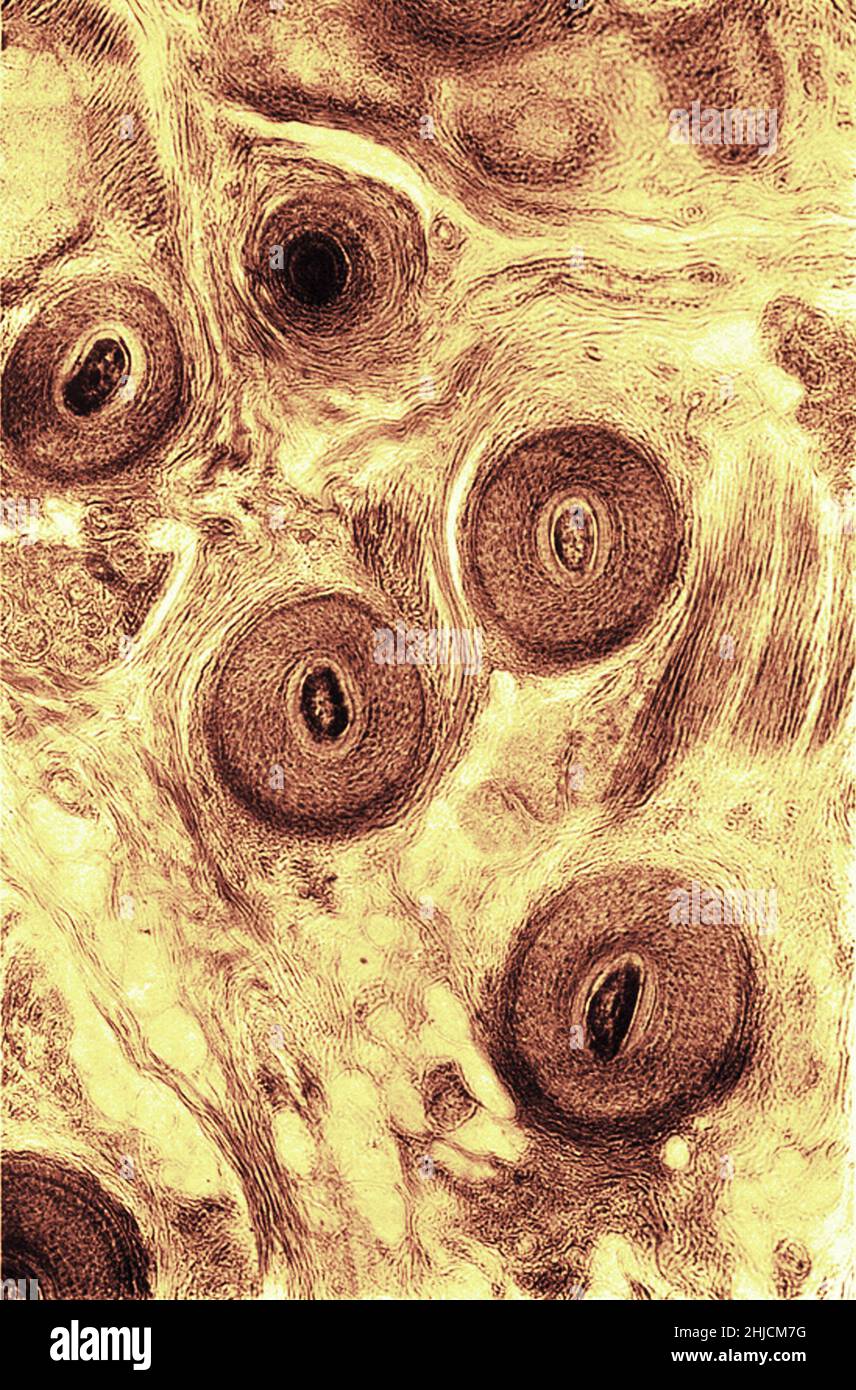 Transverse section of human scalp. Magnification: 100x. Photomicrograph ...
