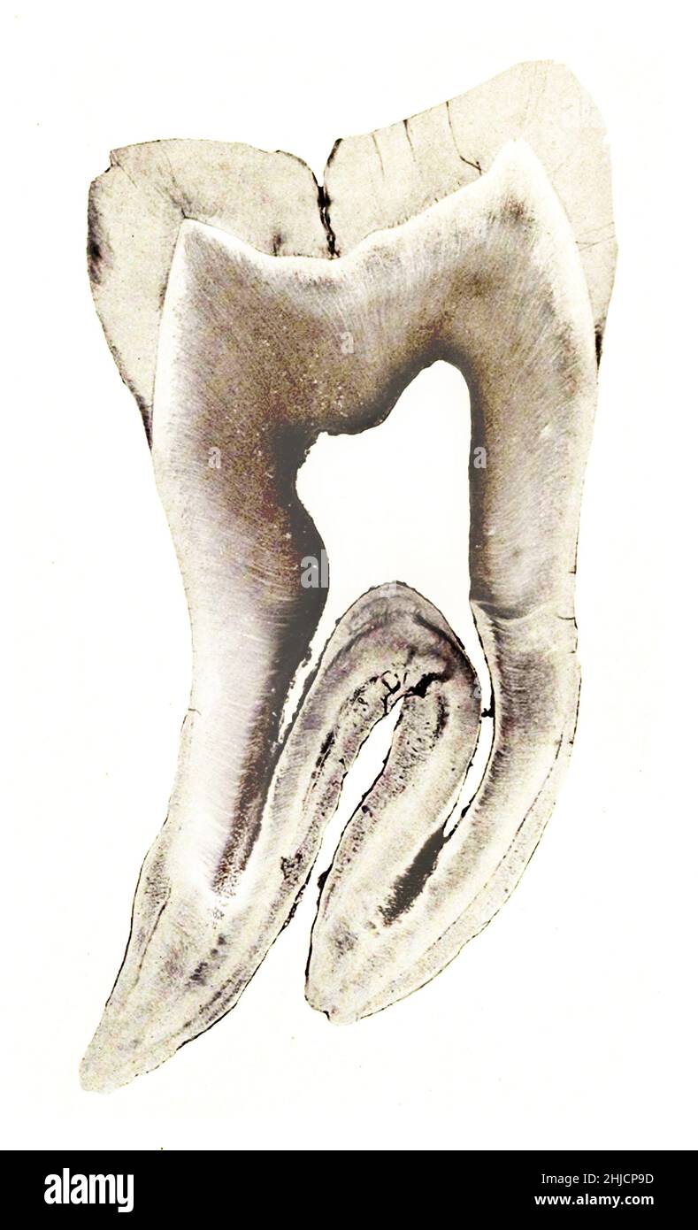 Human tooth microscope Cut Out Stock Images & Pictures - Alamy