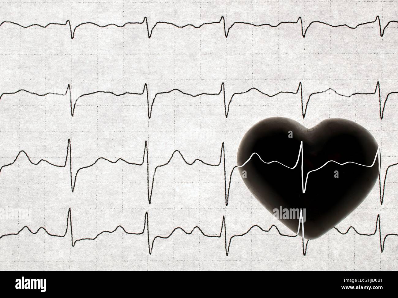 Long term ekg High Resolution Stock Photography and Images - Alamy