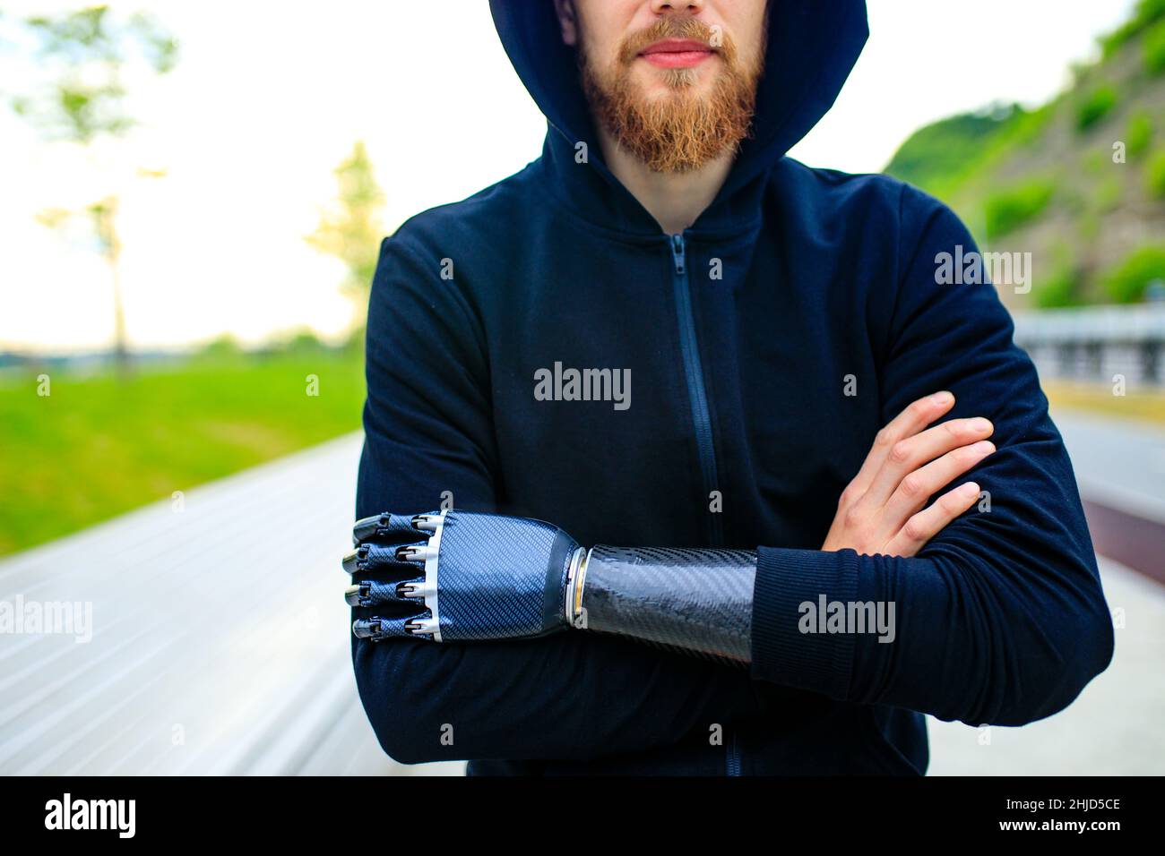 Amputee arm hi-res stock photography and images - Alamy