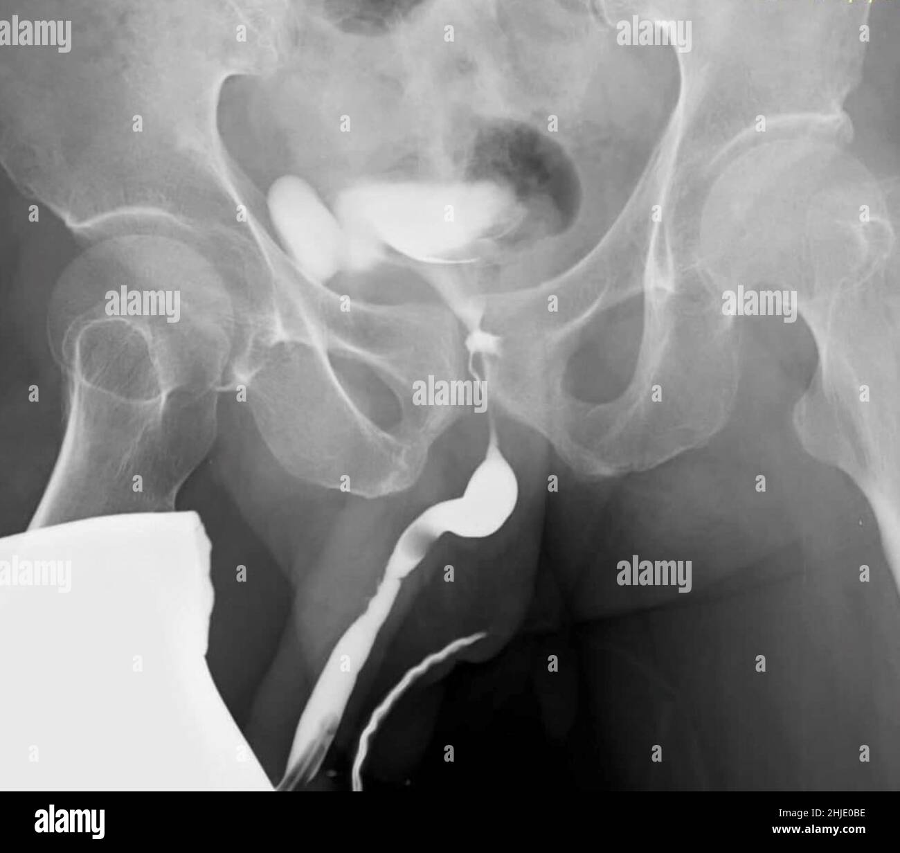 Urethra hi-res stock photography and images - Alamy