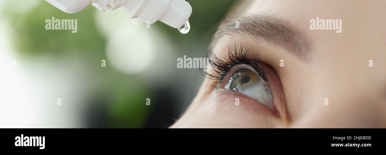 Woman drips eye drops into eye for allergies closeup Stock Photo - Alamy