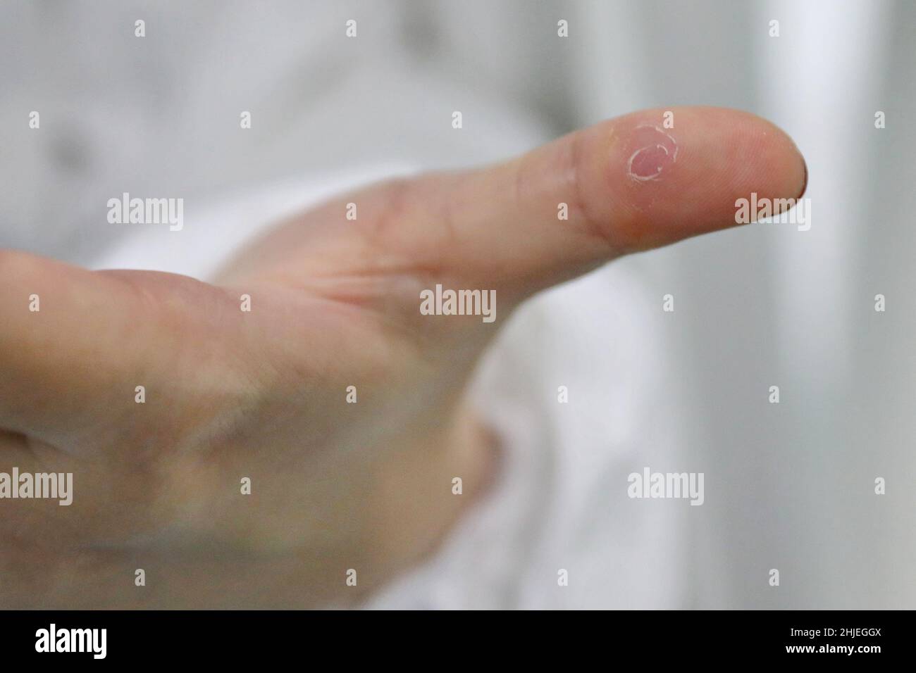 JIAXING, CHINA - JANUARY 28, 2022 - A staff member has a callus on his ...