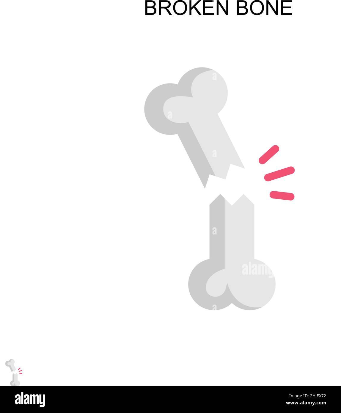 Bone fracture healing Stock Vector Images - Alamy