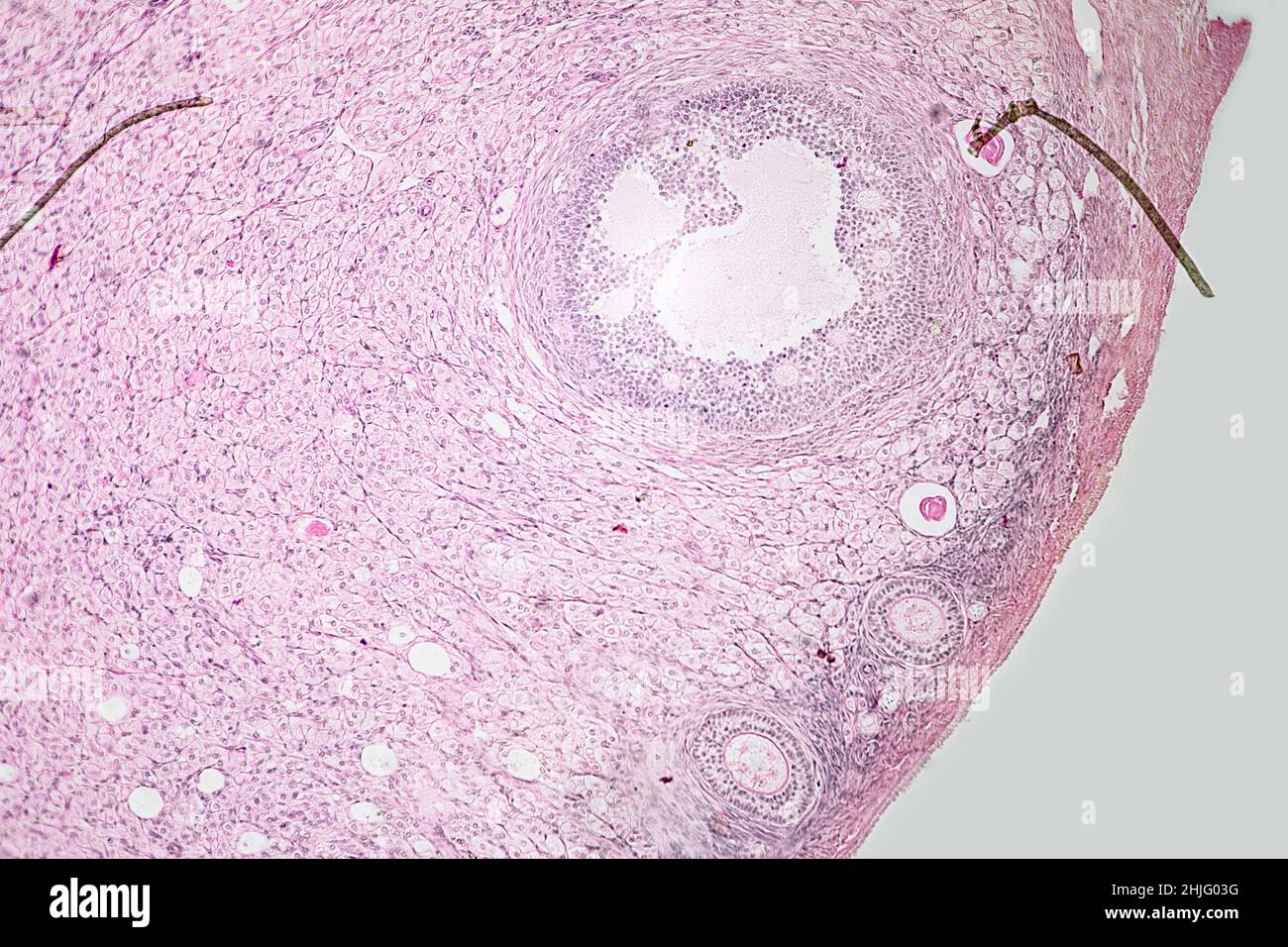 Ovary of a mammal, VS as viewed through a light microscope Stock Photo ...