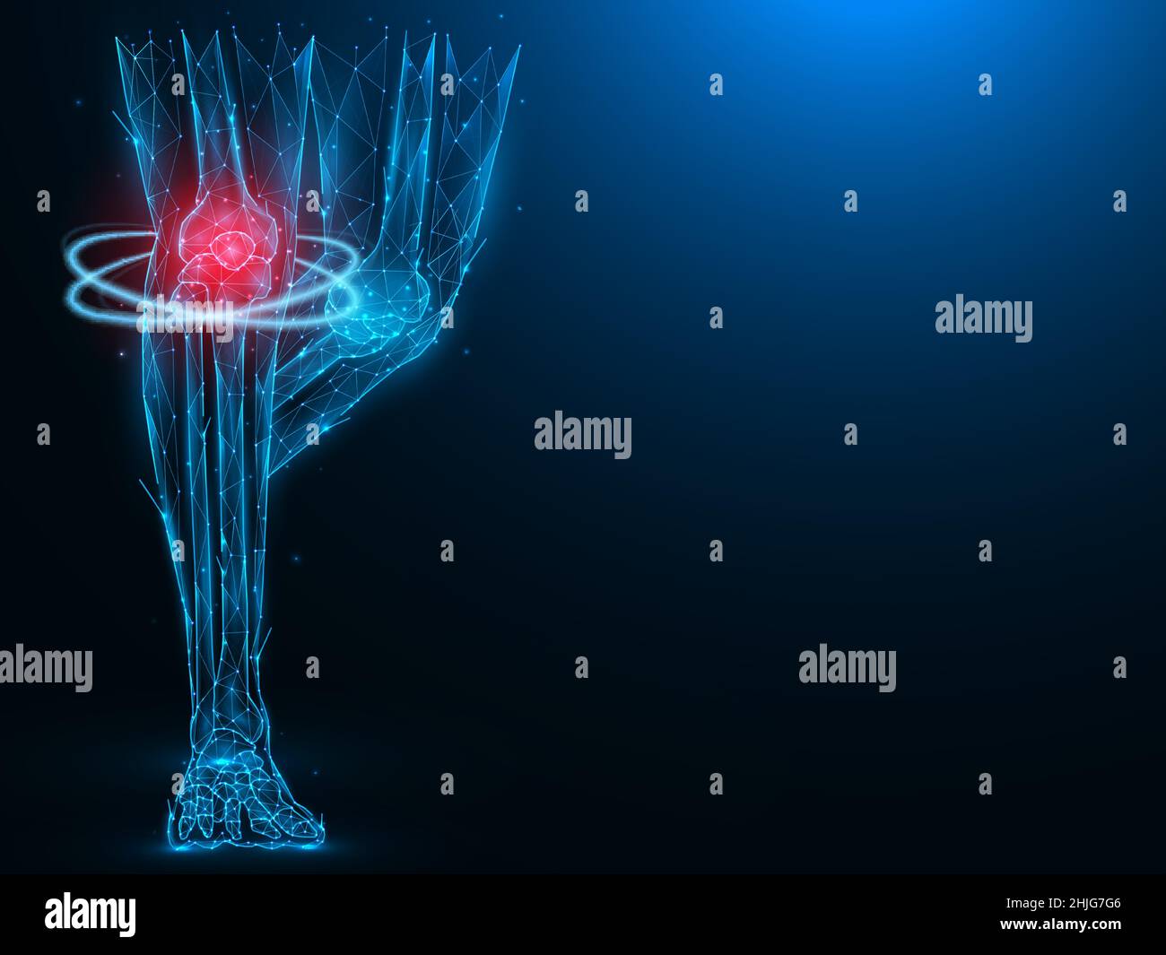 Polygonal vector illustration of human legs, painful and inflamed knee ...