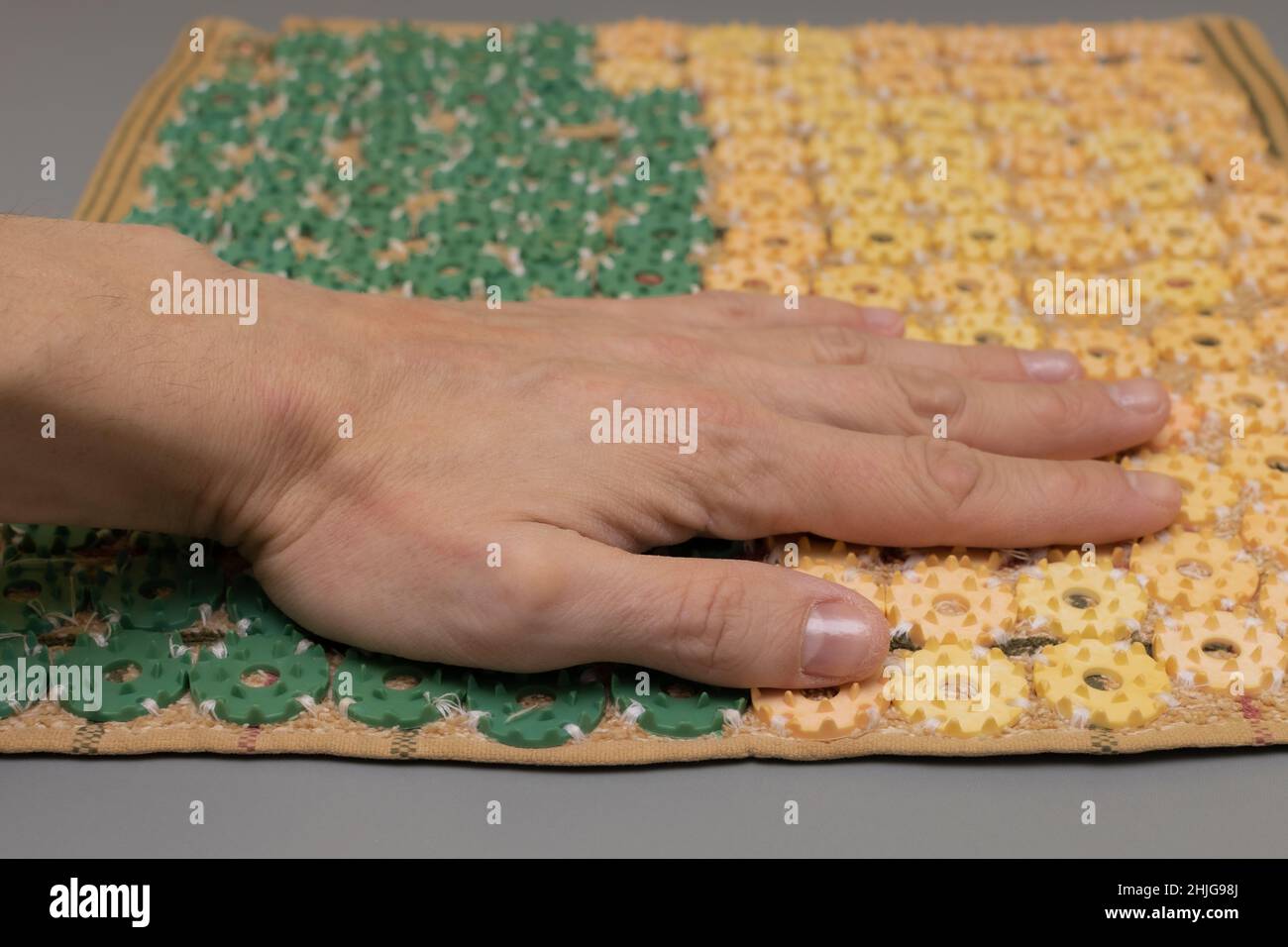 a man's hand lies on the sharp spikes of a medical applicator. High ...
