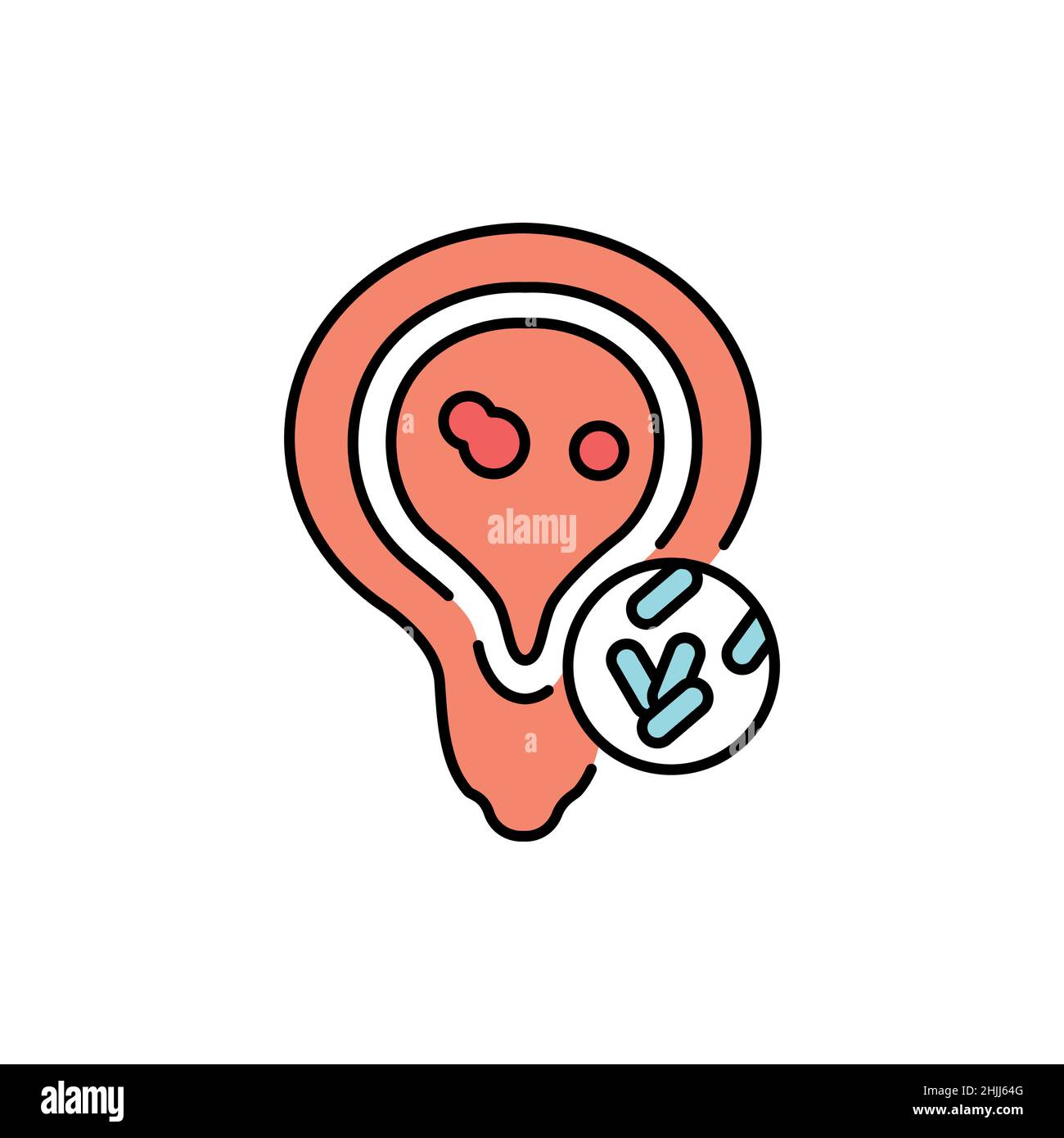 Cystitis drawing hi-res stock photography and images - Alamy