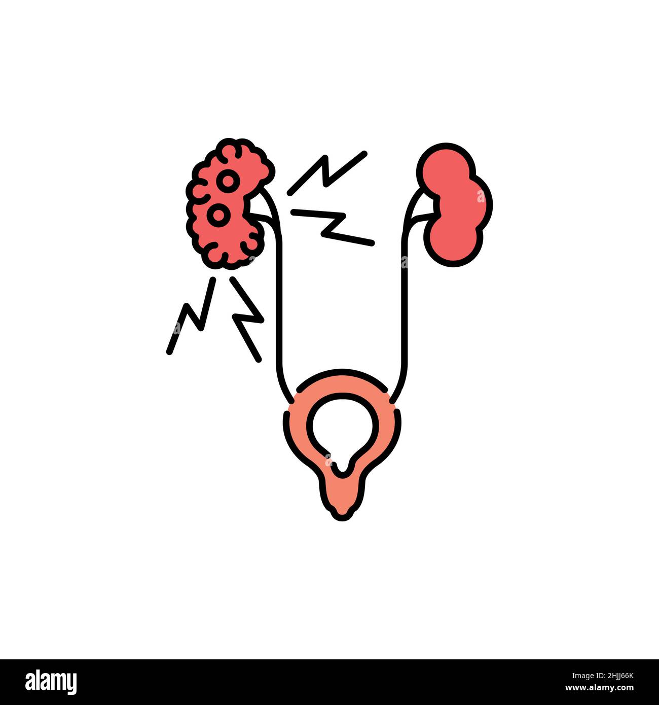 Pyelonephritis color line icon. Pictogram for web page, mobile app ...