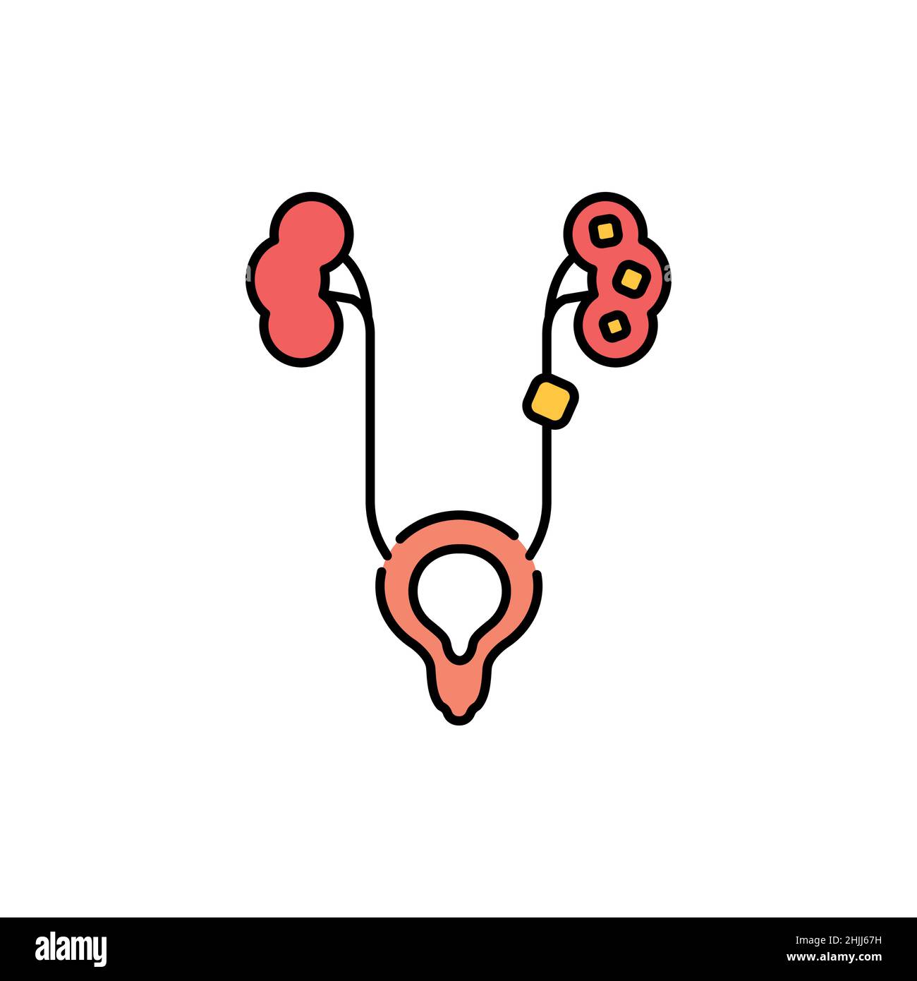 Urolithiasis vector vectors hi-res stock photography and images - Alamy