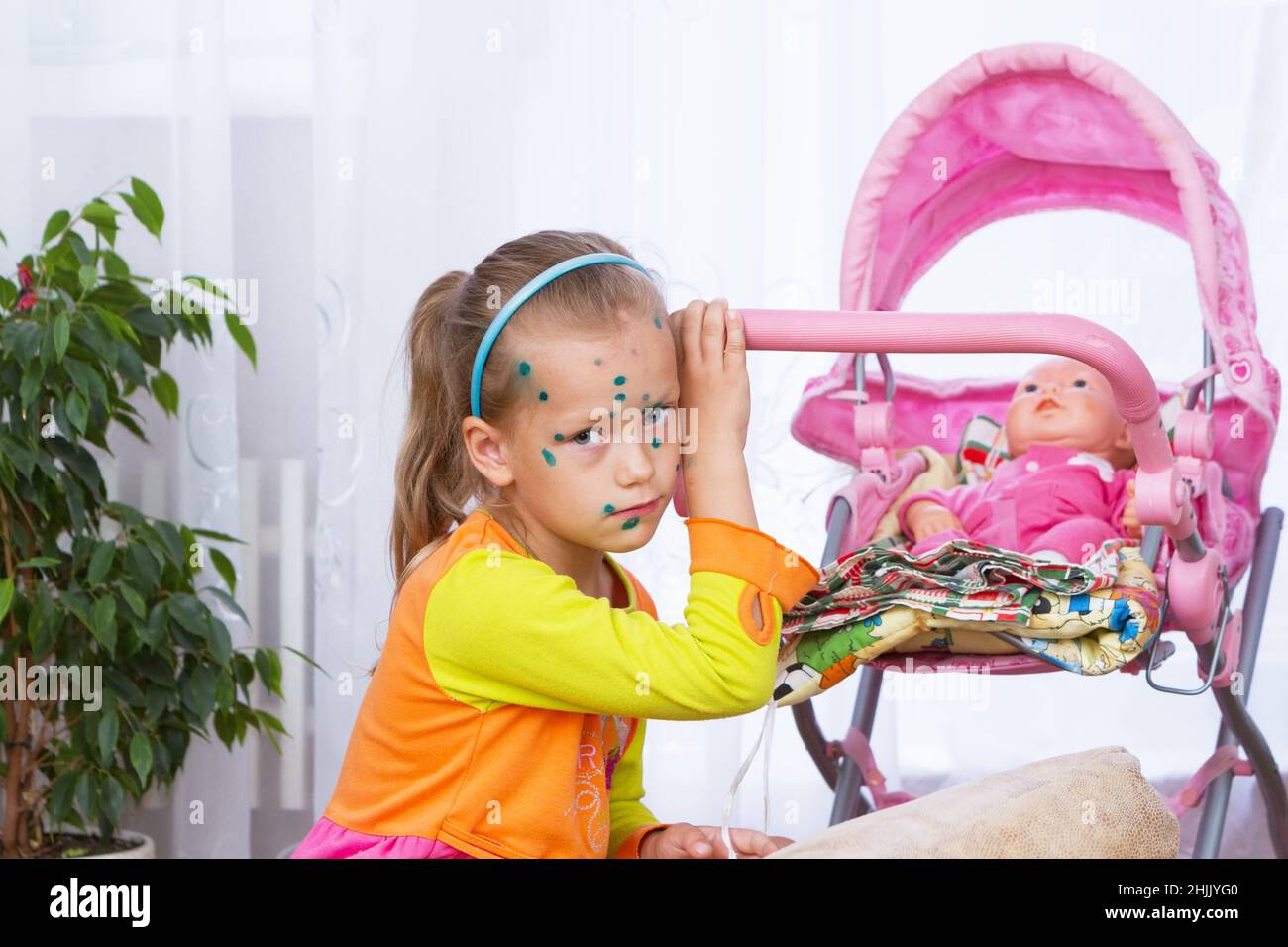 Child suffering from smallpox hi-res stock photography and images - Alamy