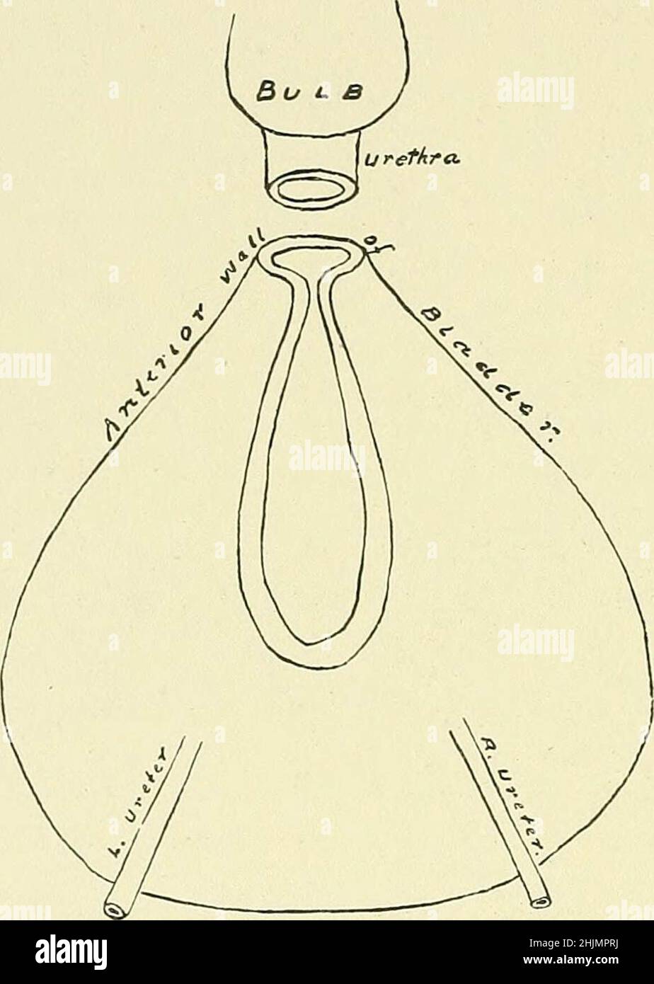 Prostate history hi-res stock photography and images - Alamy