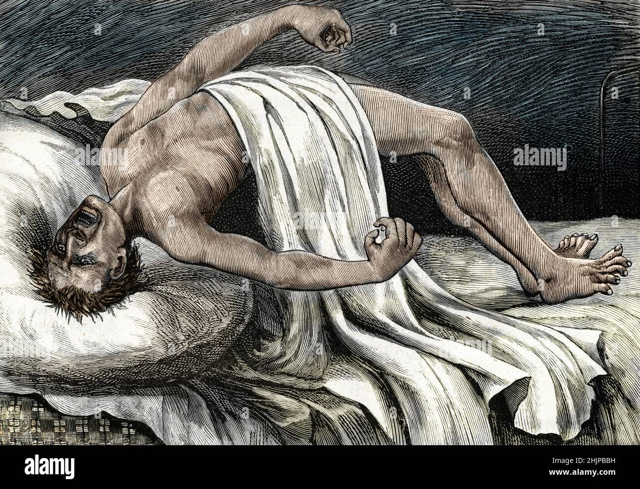 Douleur de dos hi-res stock photography and images - Alamy