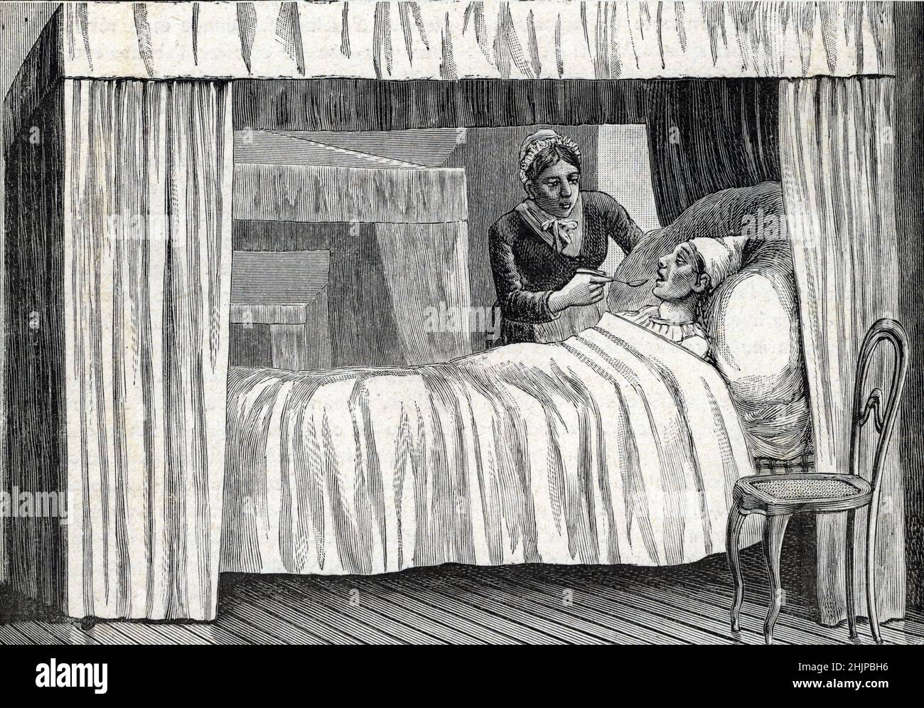 Malade atteint de la fievre tiphoide, les traits du visage sont ...