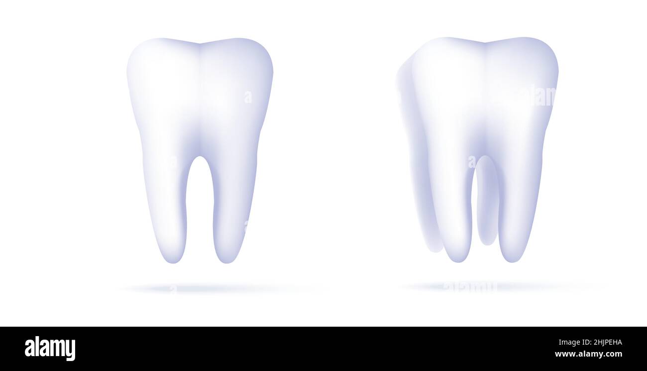 Tooth, 3D render icons set, front view and in perspective with healthy ...