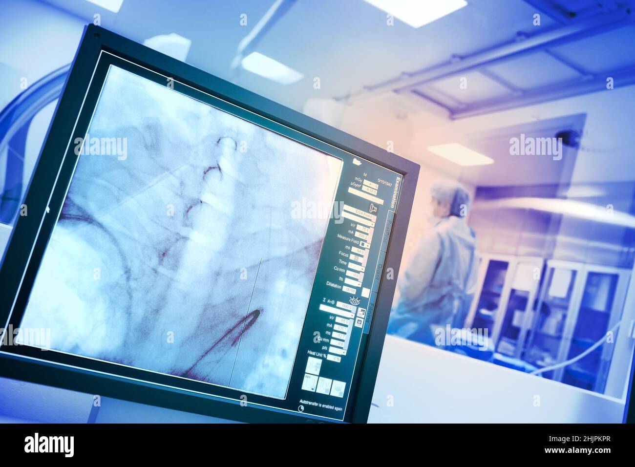 X-ray monitoring of surgical procedure in the hospital cathlab Stock ...