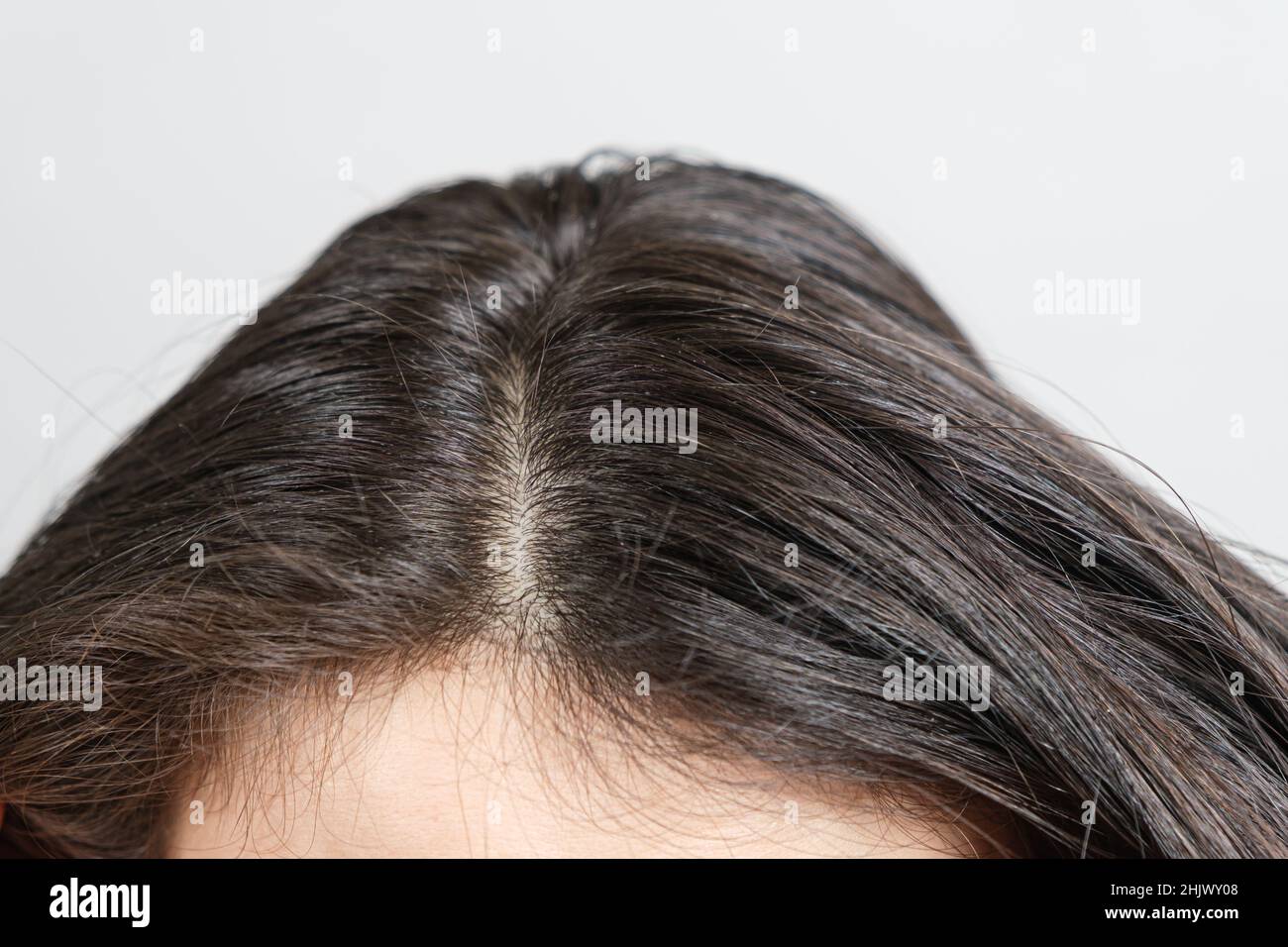 Unwashed Greasy Hair Men