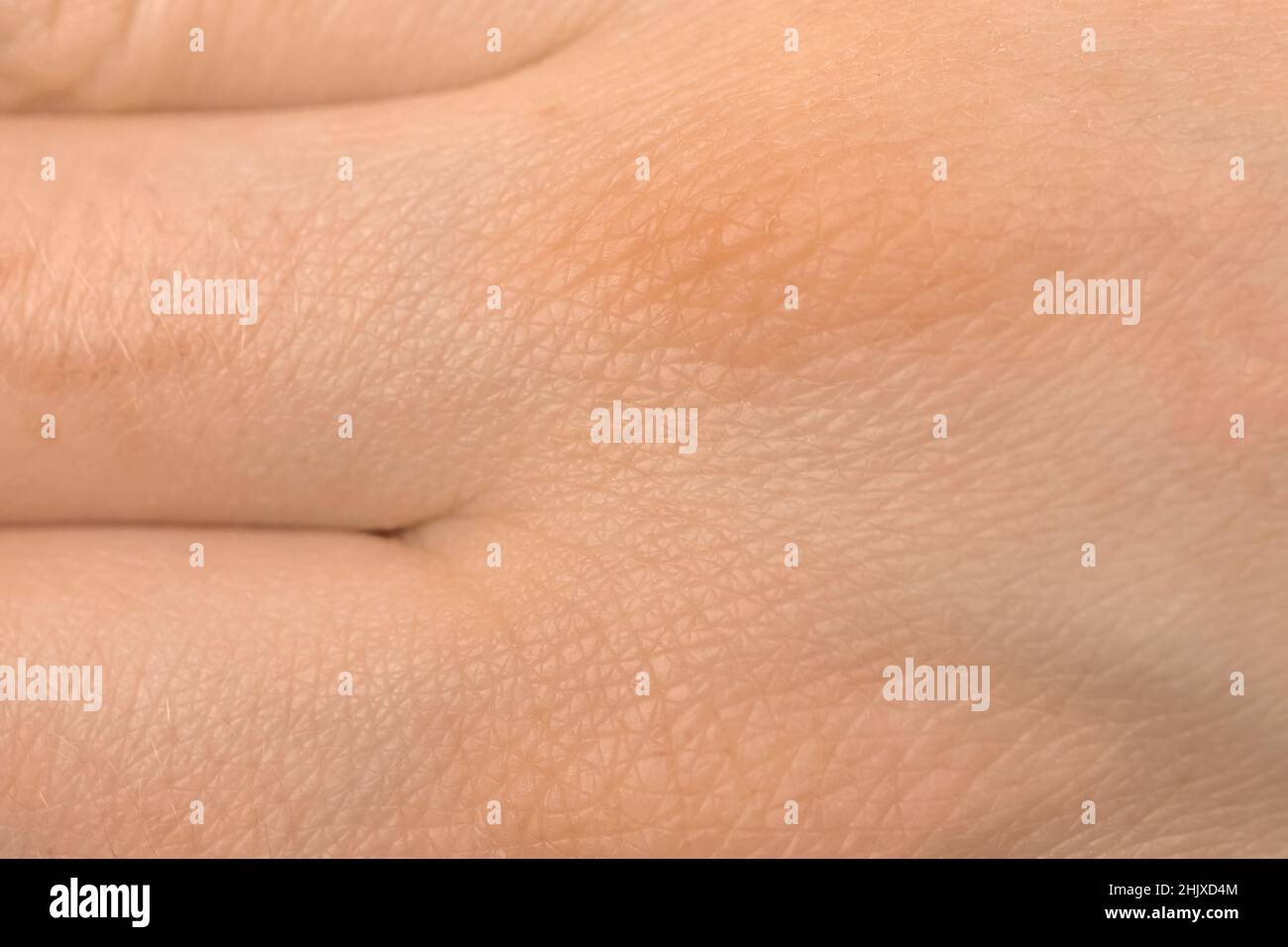 Human hand skin texture. Detail healthy pink skin background Stock ...