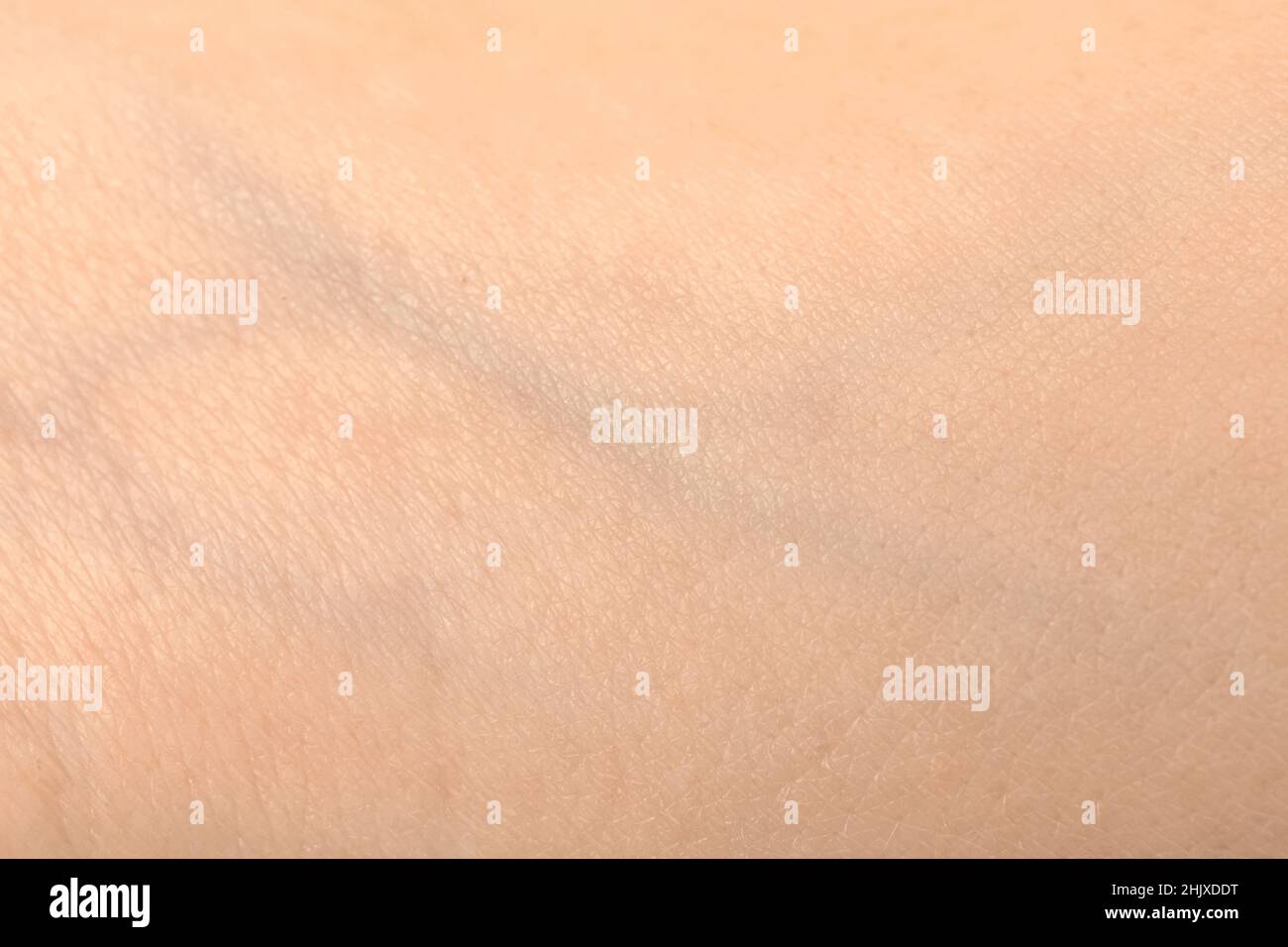 Veiny woman hi-res stock photography and images - Alamy