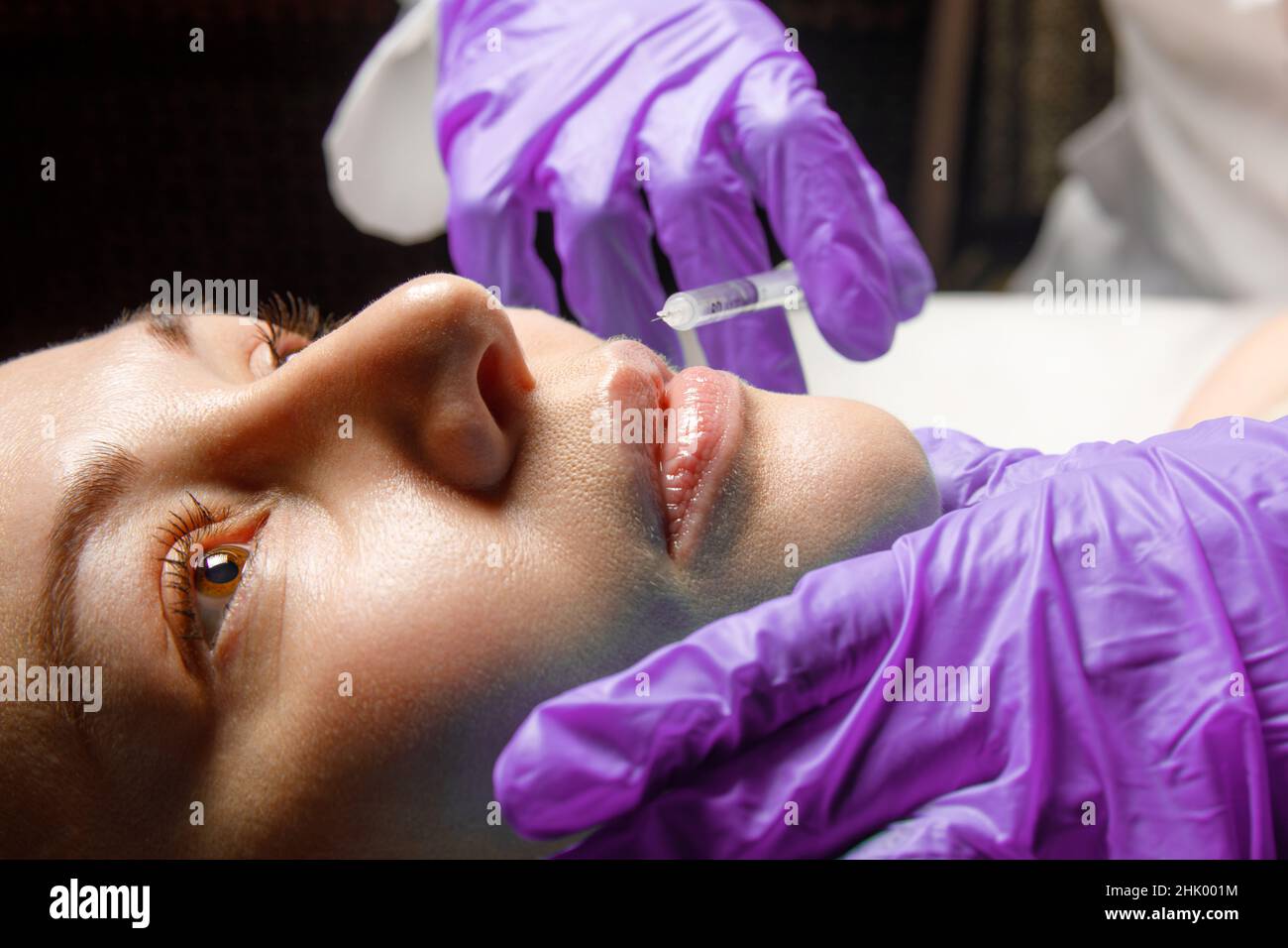 Lip shape correction procedure in a cosmetology salon. The specialist ...