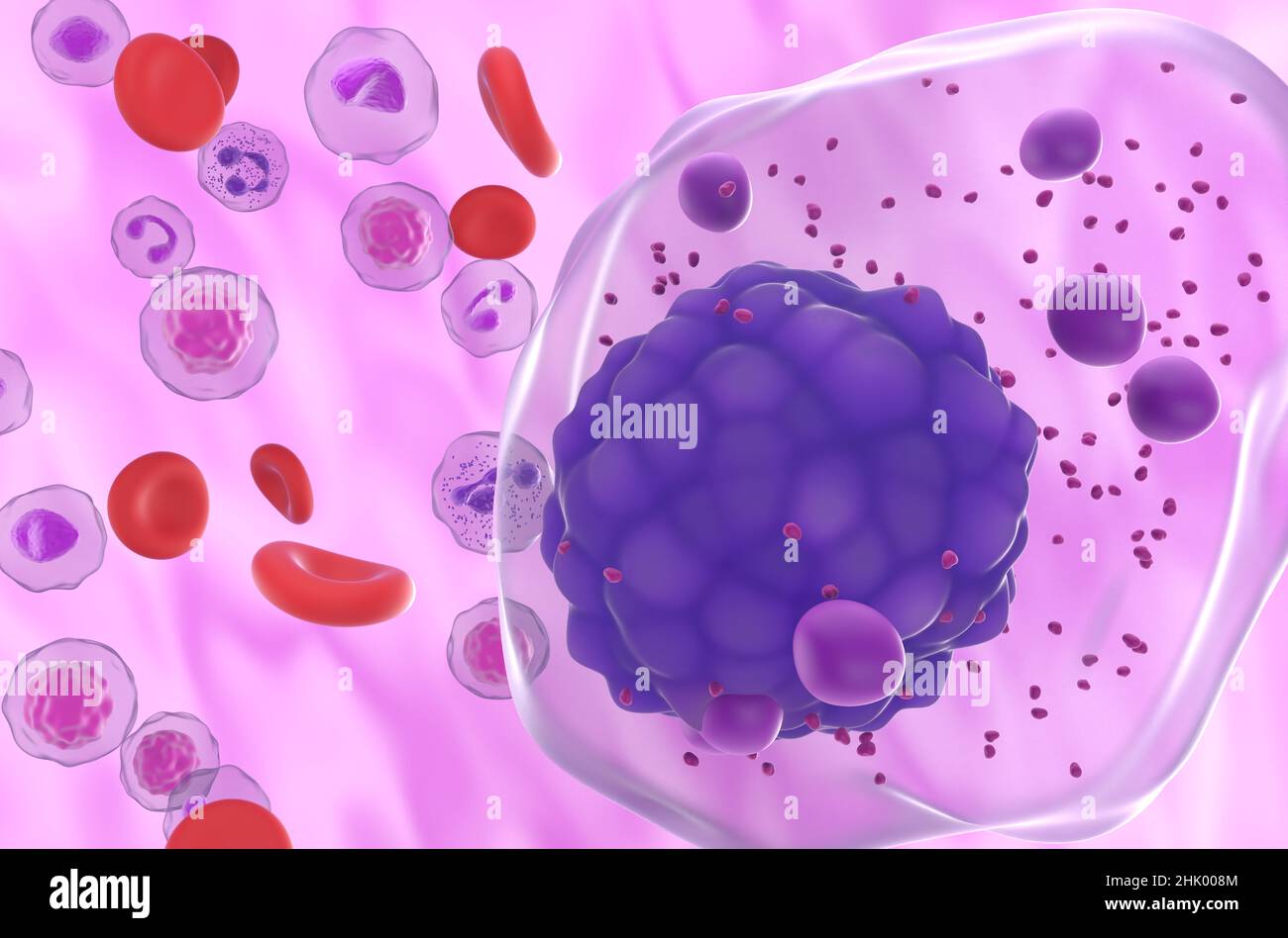 Multiple myeloma plasma cells hi-res stock photography and images - Alamy