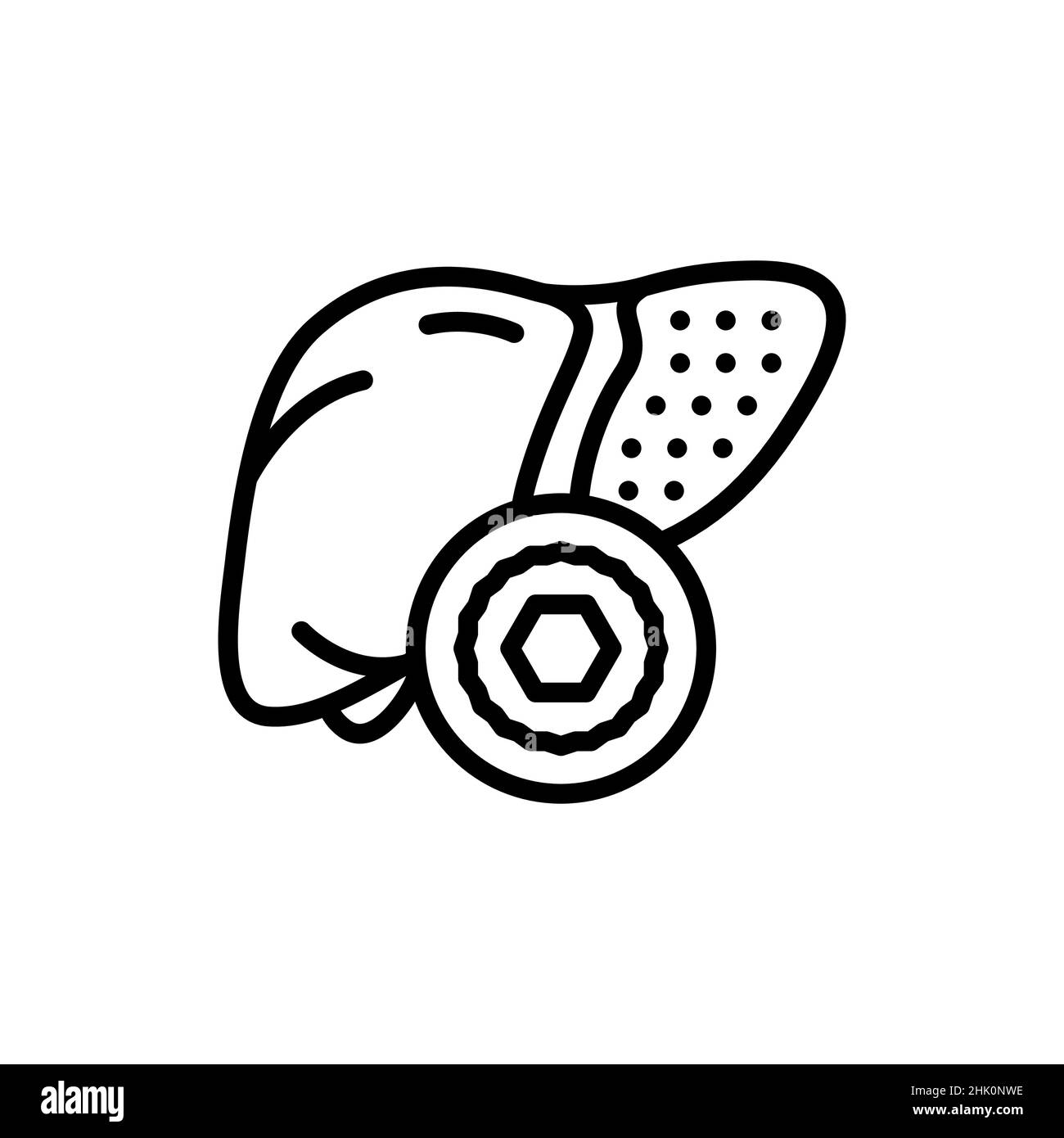 Liver cirrhosis drawing hi-res stock photography and images - Alamy