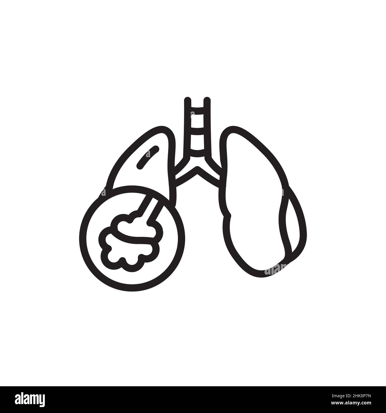 Pneumonia color line icon. Isolated vector element. Outline pictogram ...