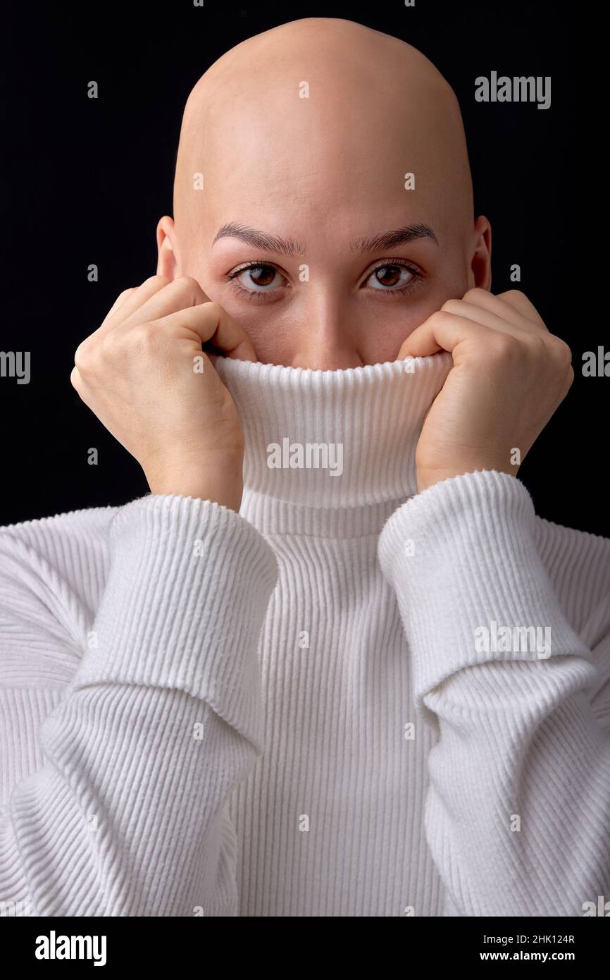 Half bald head hi-res stock photography and images - Alamy