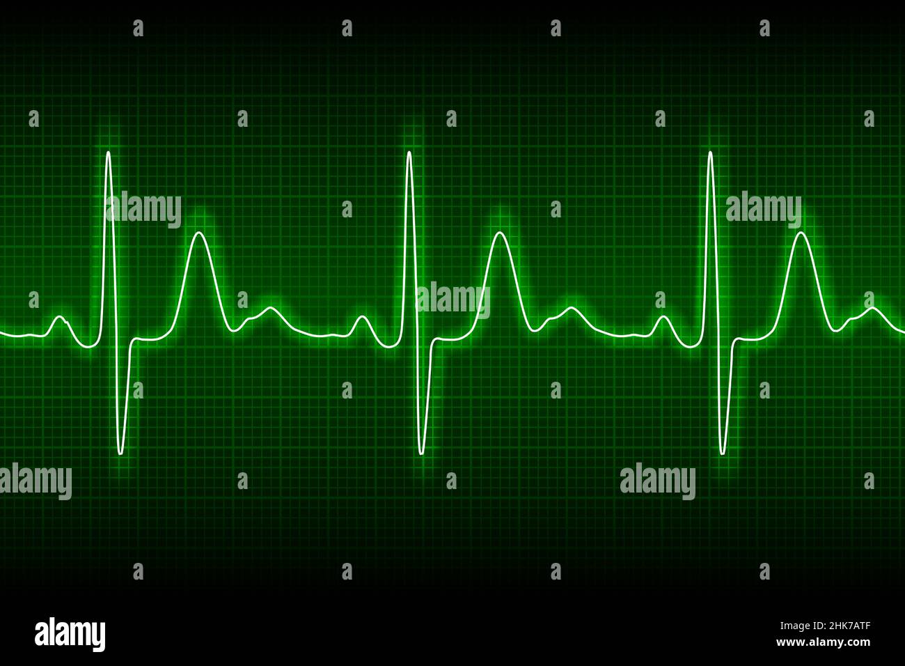 Heart beat ecg or ekg seamless neon line on green background ...