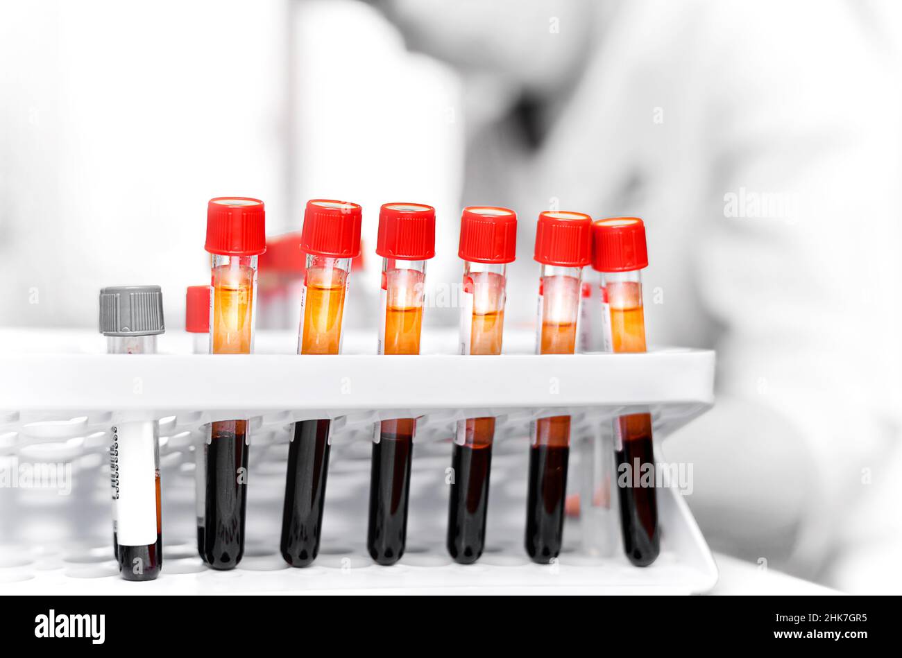 Test tubes with blood in color on the black and white background of the ...