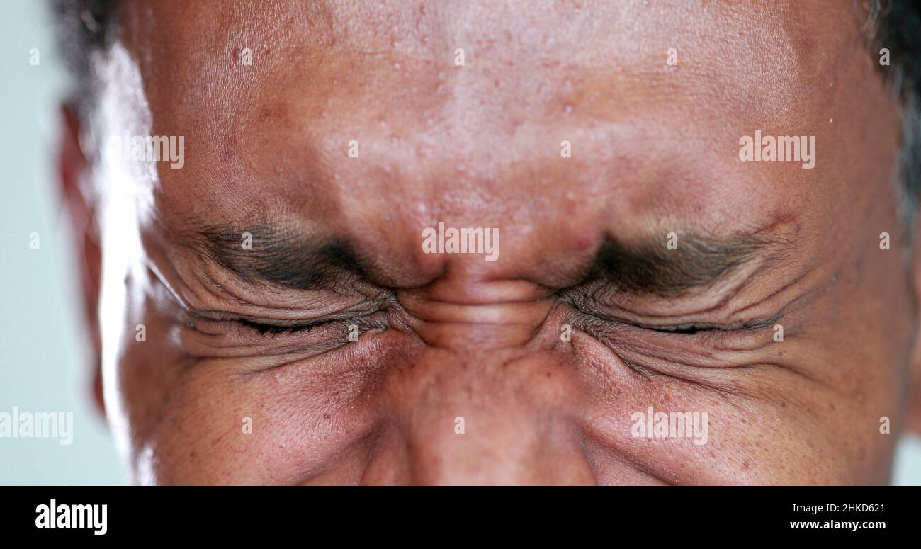 African man eyes squinting. Close-up black guy closing eyes squint ...