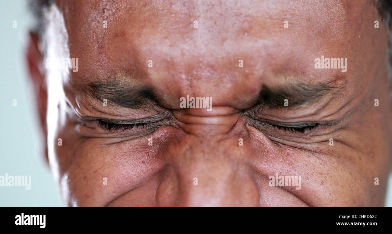African man eyes squinting. Close-up black guy closing eyes squint ...