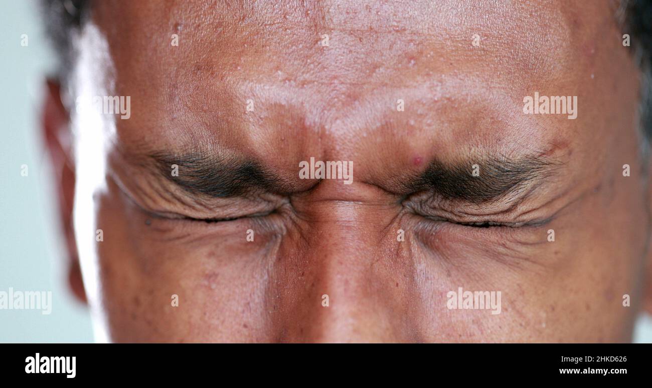 African man eyes squinting. Close-up black guy closing eyes squint ...