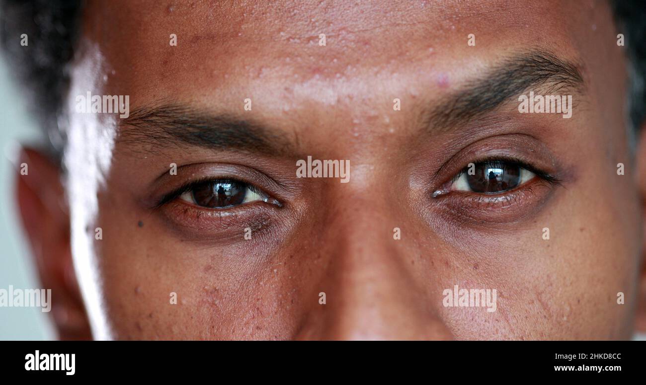 Tearful person close-up eyes feeling sad and depressed. African ...