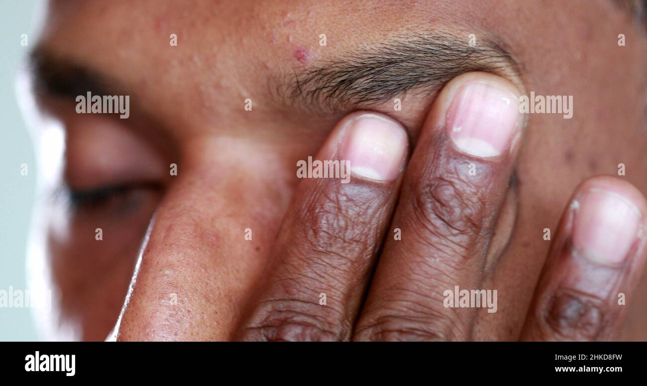 Tired man rubbbing eye with hand. Exhausted african american touching ...