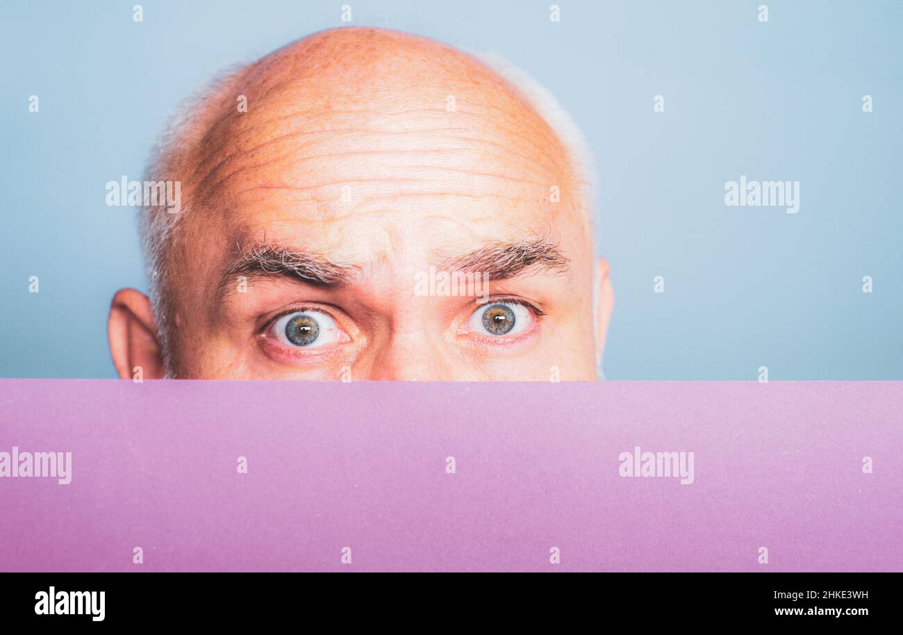 Bold senior man. Close up Bold sad man worrying about hair loss problem ...