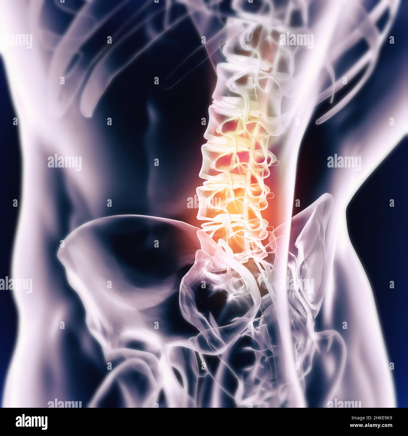When inflammation strikes. A cgi view of an inflamed joint isolated on ...