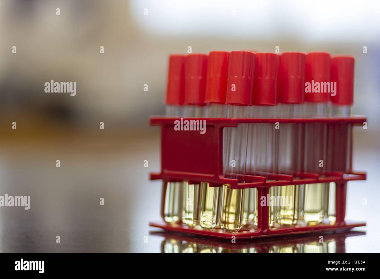 Biochemical tests bacteria hi-res stock photography and images - Alamy