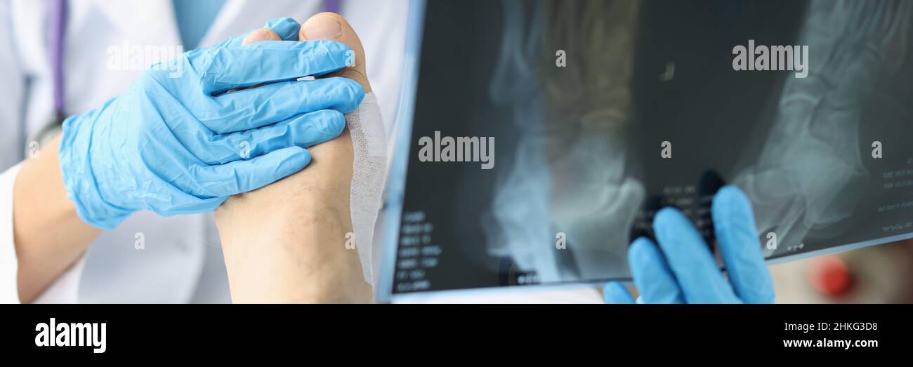 Doctor looking at xray of foot and examining patient leg closeup Stock ...
