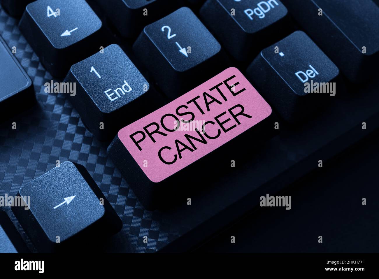 Conceptual caption Prostate Cancer. Word Written on Cancer that occurs ...