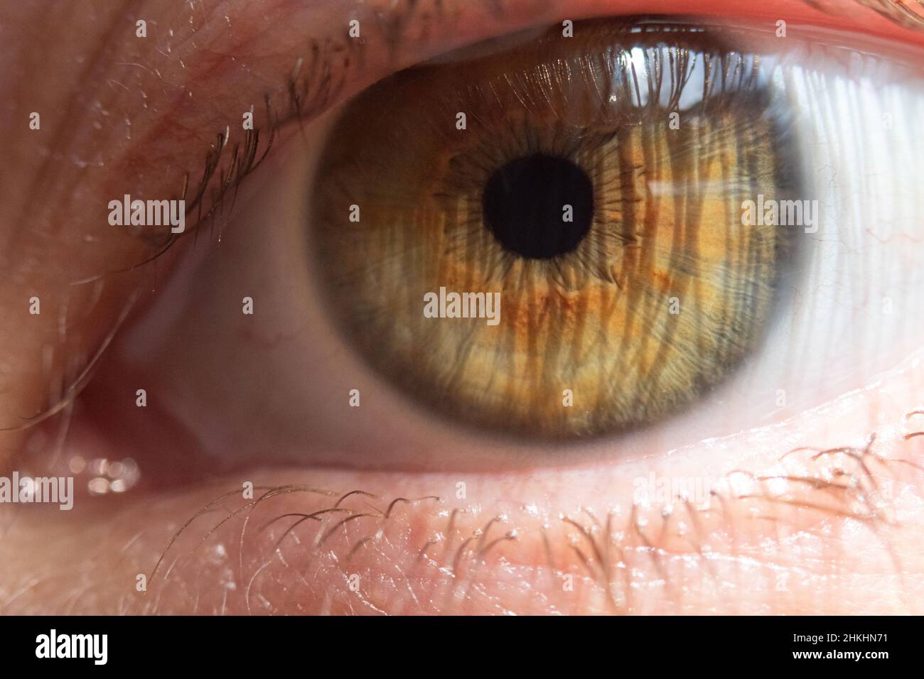 People With Natural Yellow Eyes