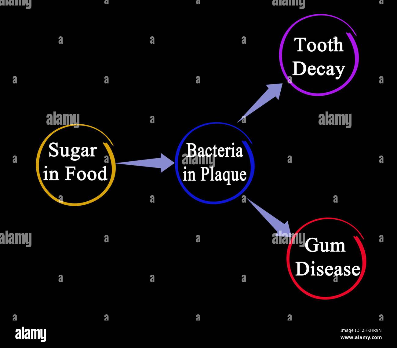 From Sugar in Food to diseases Stock Photo - Alamy