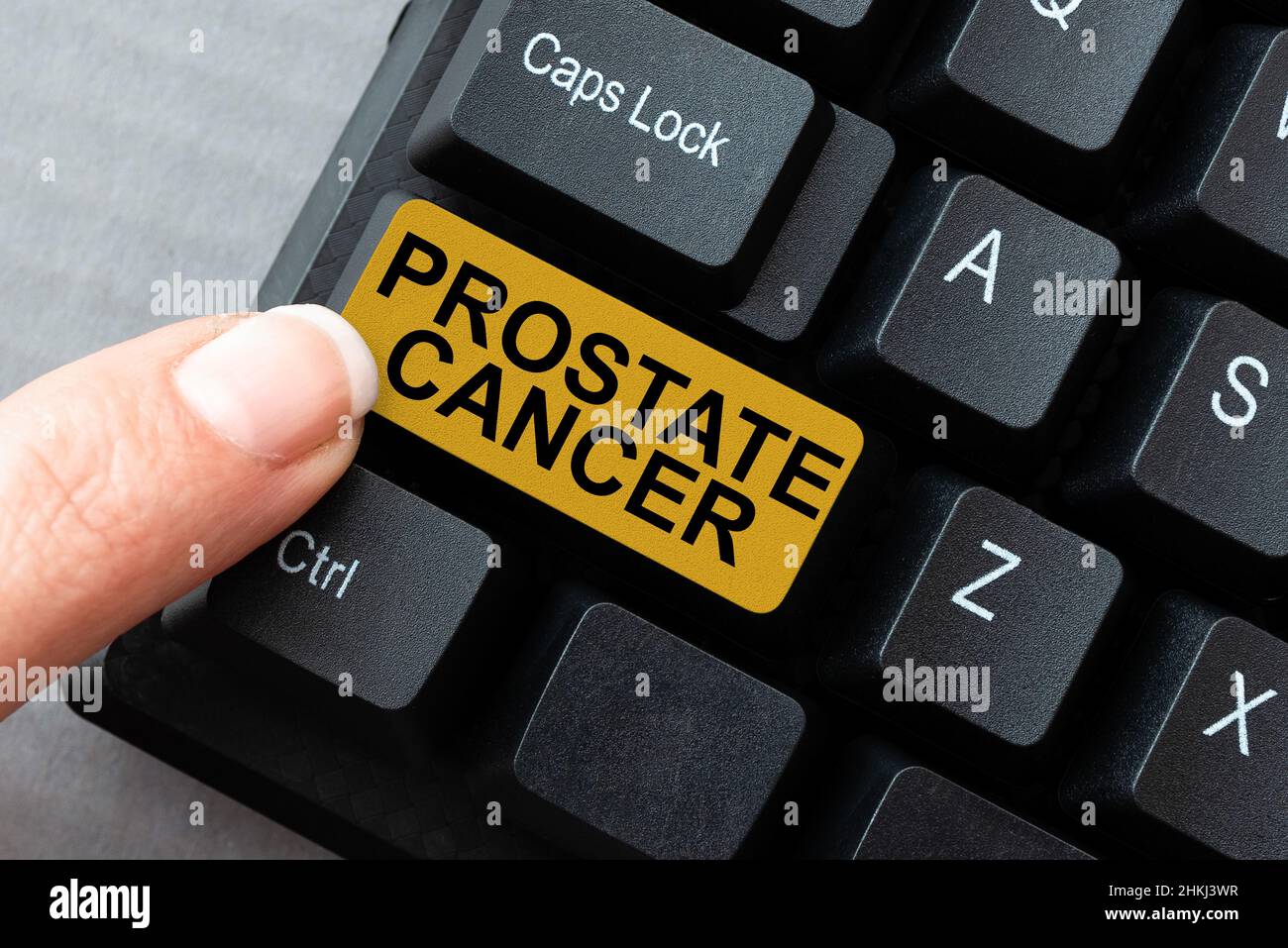 Inspiration showing sign Prostate Cancer. Word for Cancer that occurs ...