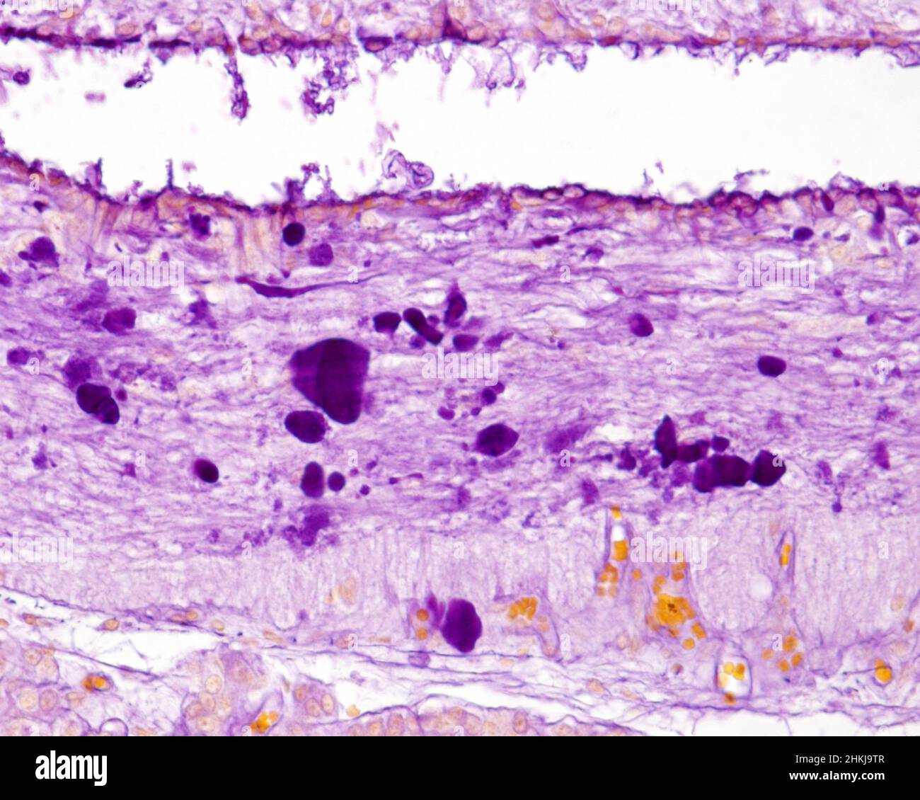 Infundibular Stalk Histology