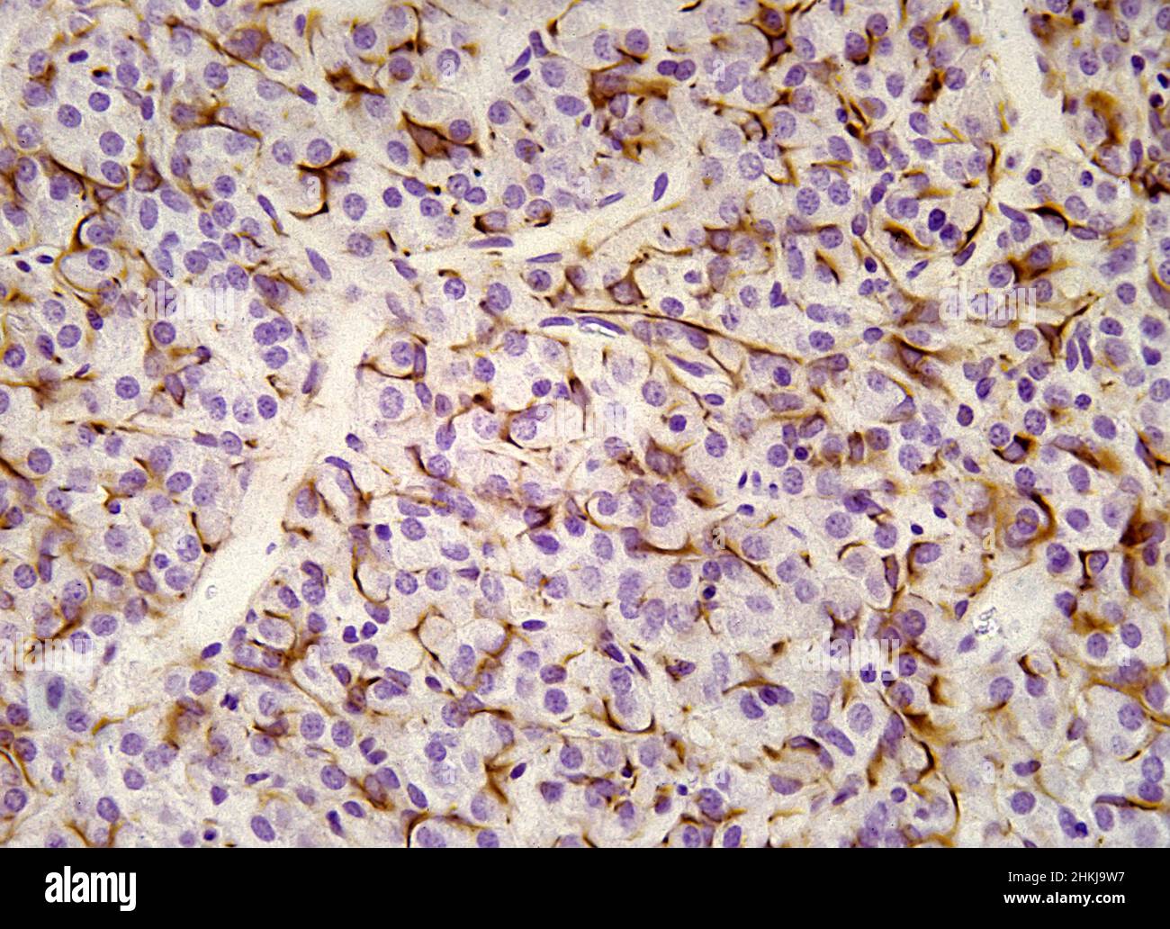 Folliculostellate cells of pituitary gland, light micrograph Stock ...